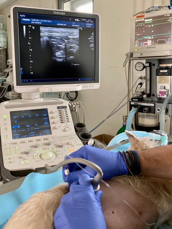 Formation Anesthésie loco-régionale : tête-queue | CAPdouleur